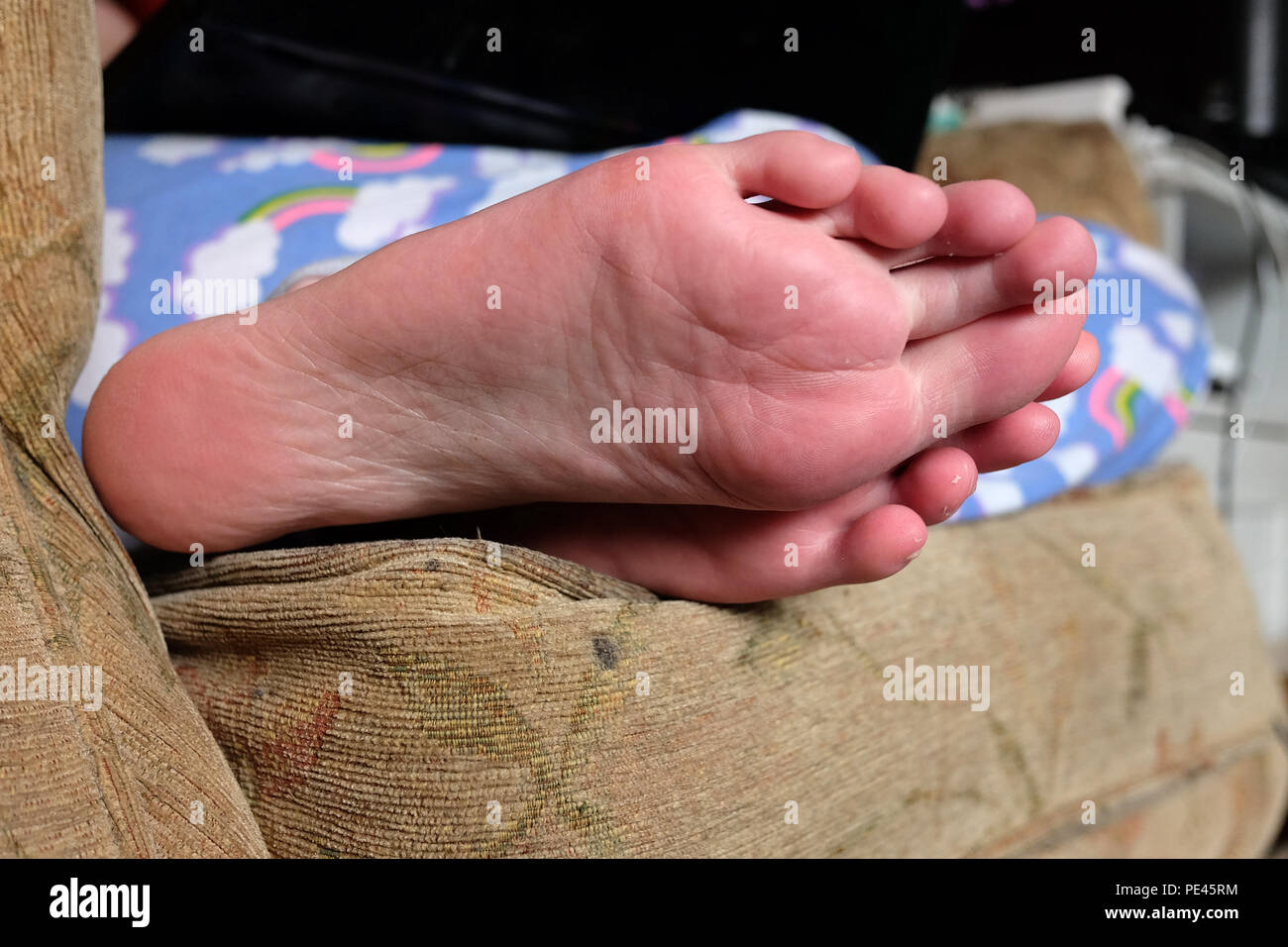 White People Feet