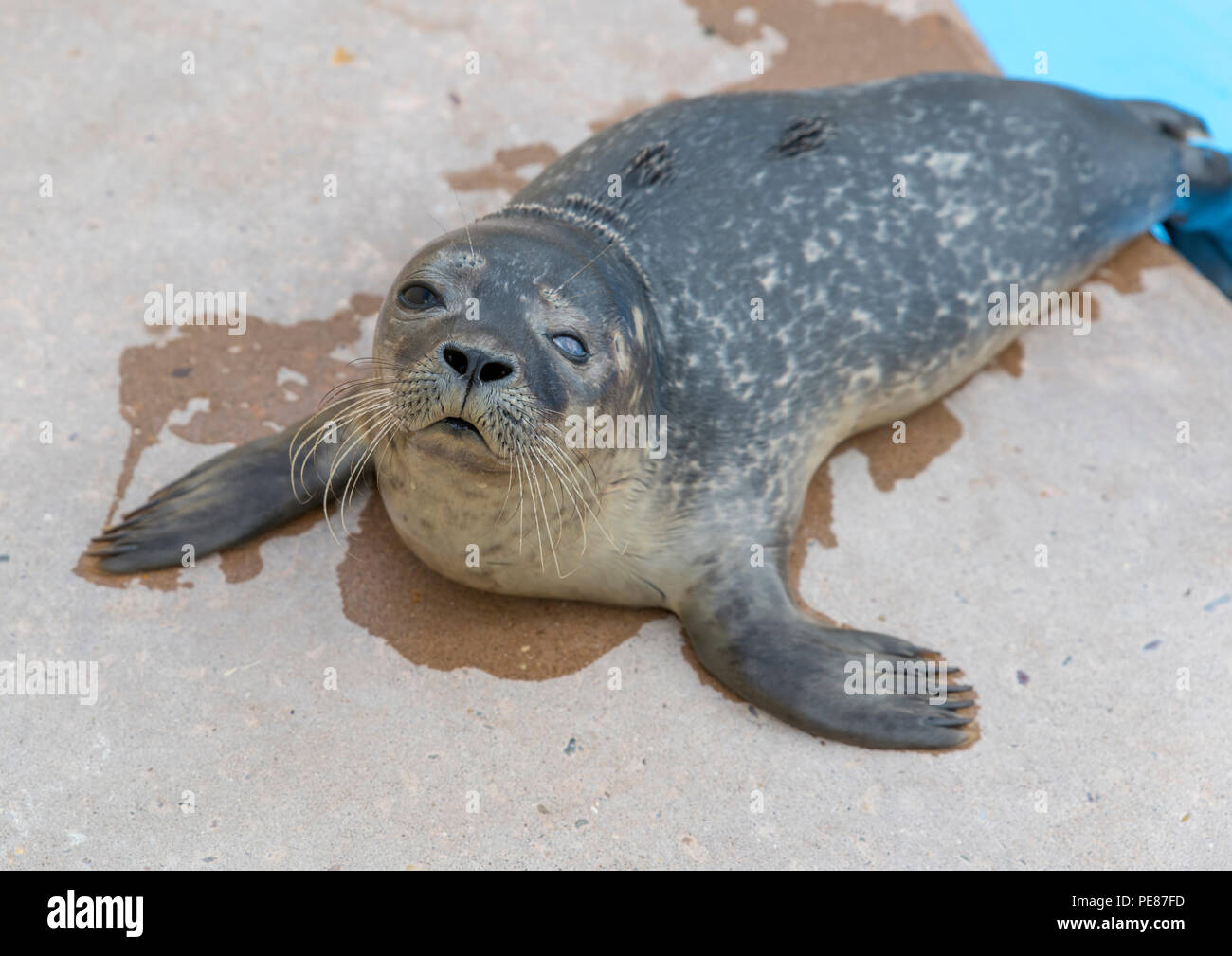 Eye infection hi-res stock photography and images - Alamy