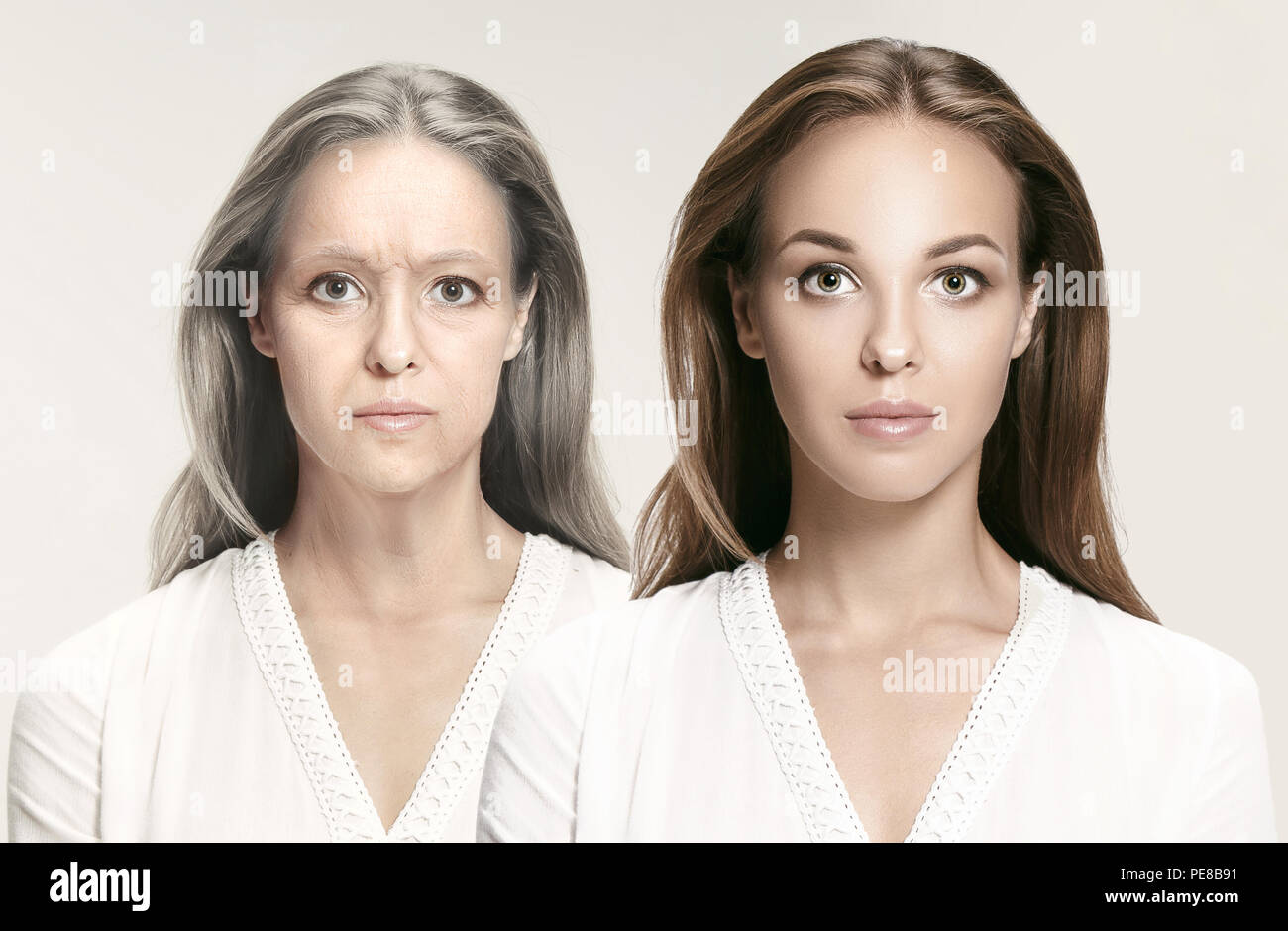 Comparison. Portrait of beautiful woman with problem and clean skin ...