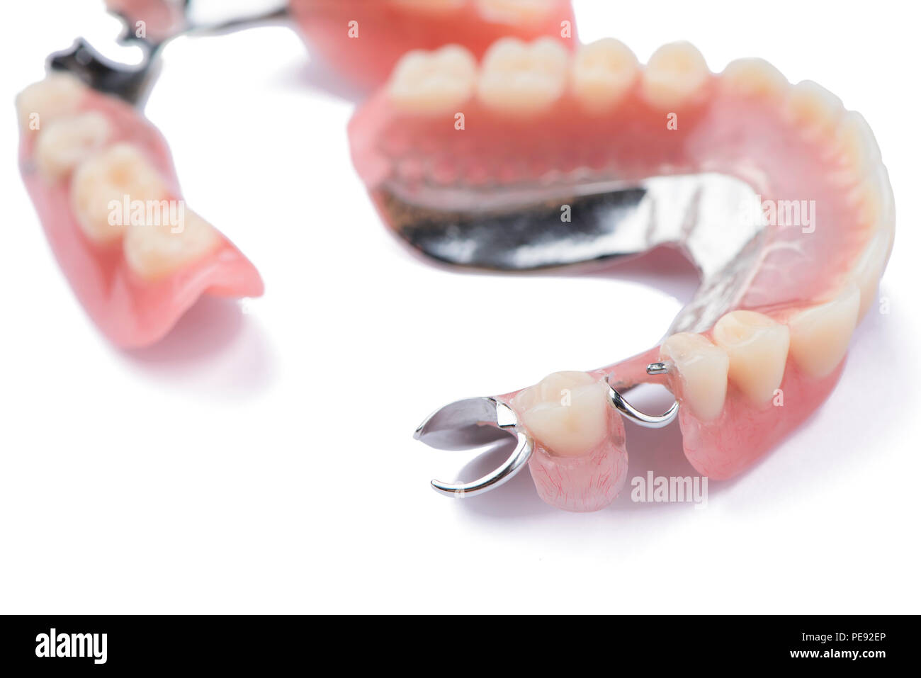 Fixed Partial Denture All Metal