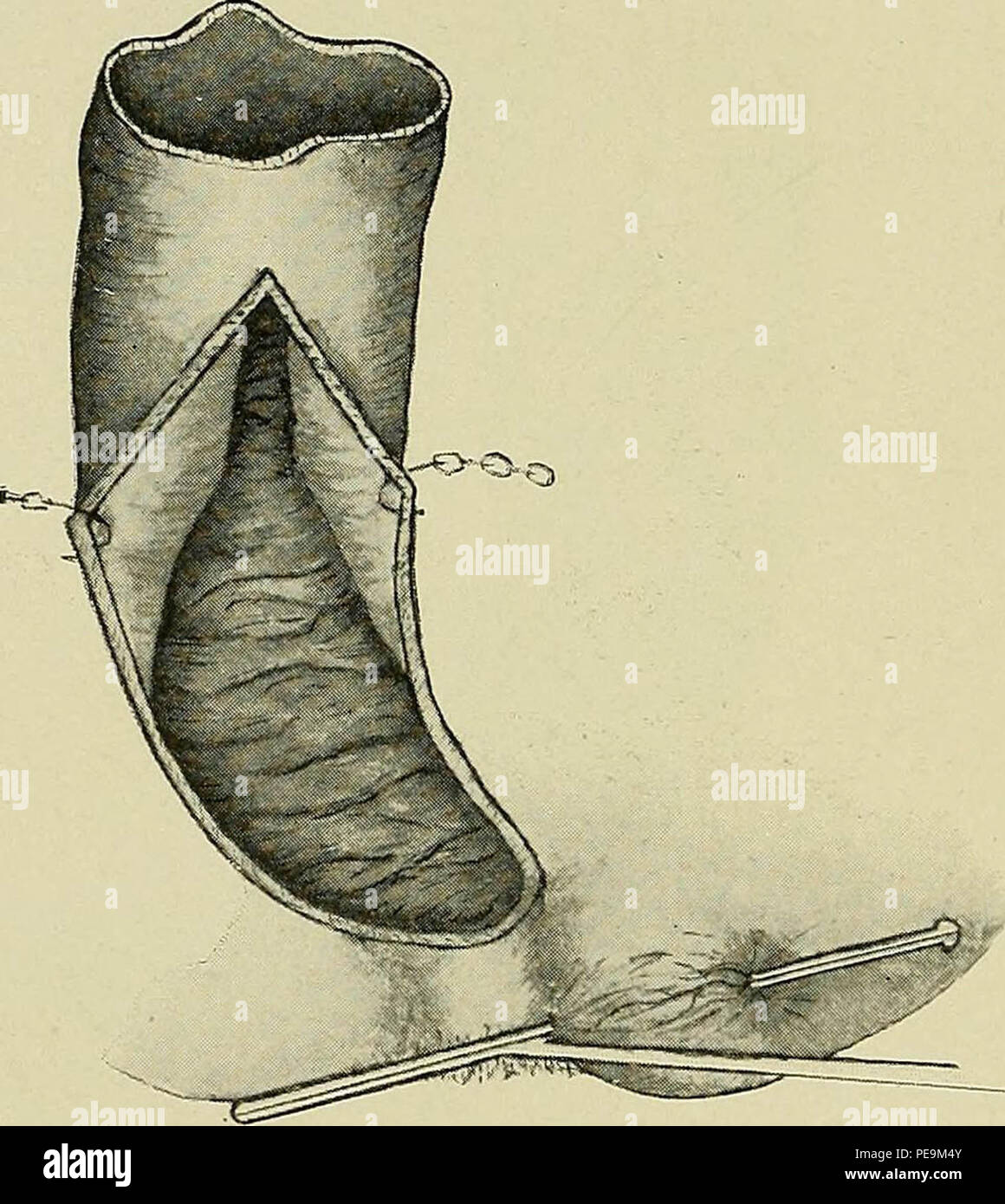 "Diseases of the rectum and anus: designed for students and ...
