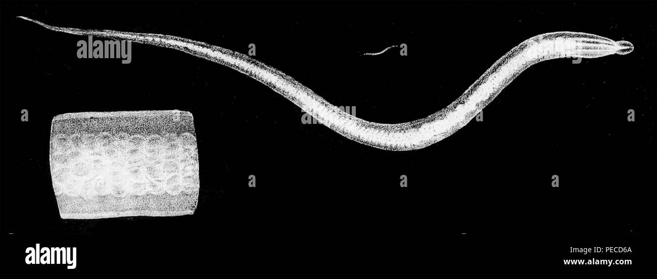 Royalty Free Ascaris Lumbricoides Pictures Images And Stock Photos