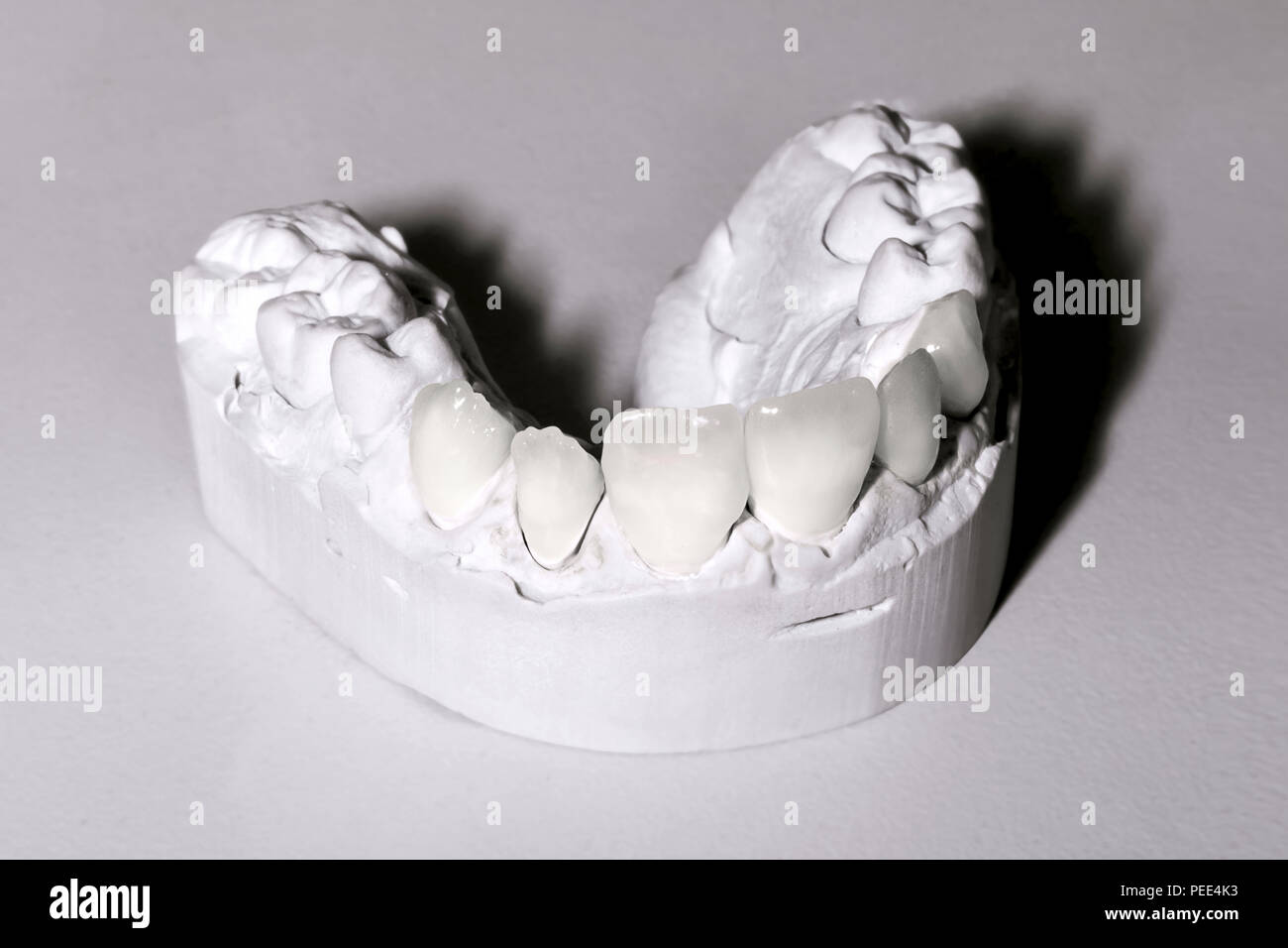 photo of dental gypsum models on the table Stock Photo - Alamy
