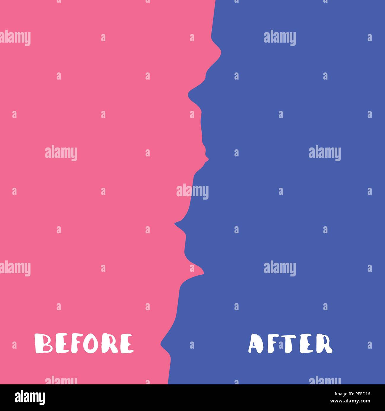 Before and After. Template background. Vector illustration Stock Vector ...