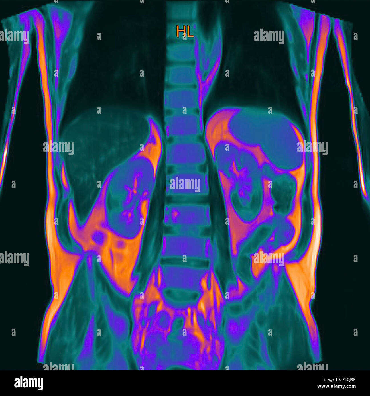 Mri scan body hi-res stock photography and images - Alamy