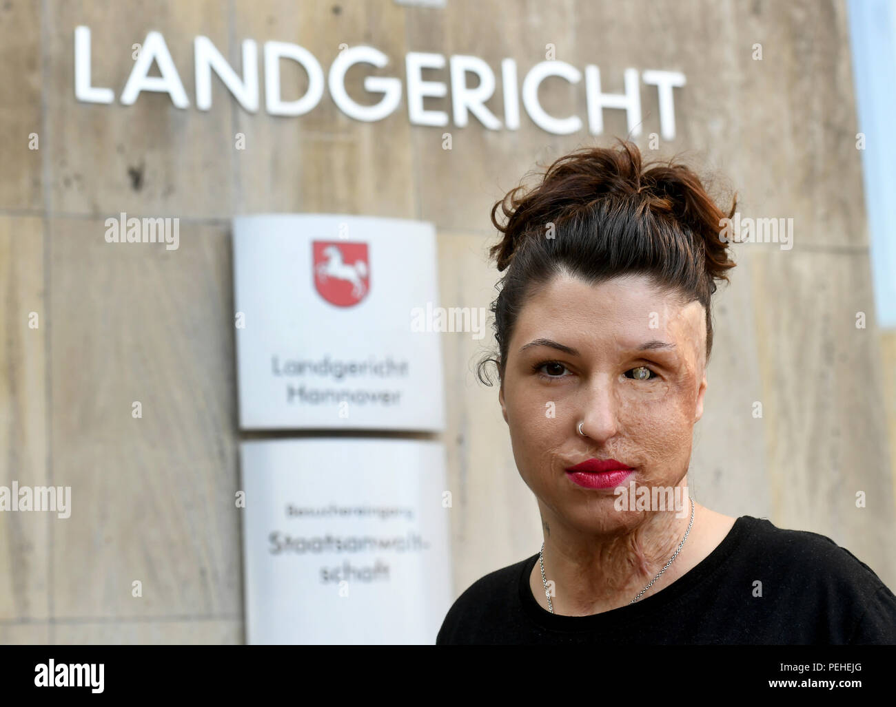 Disfigured man hi-res stock photography and images - Alamy