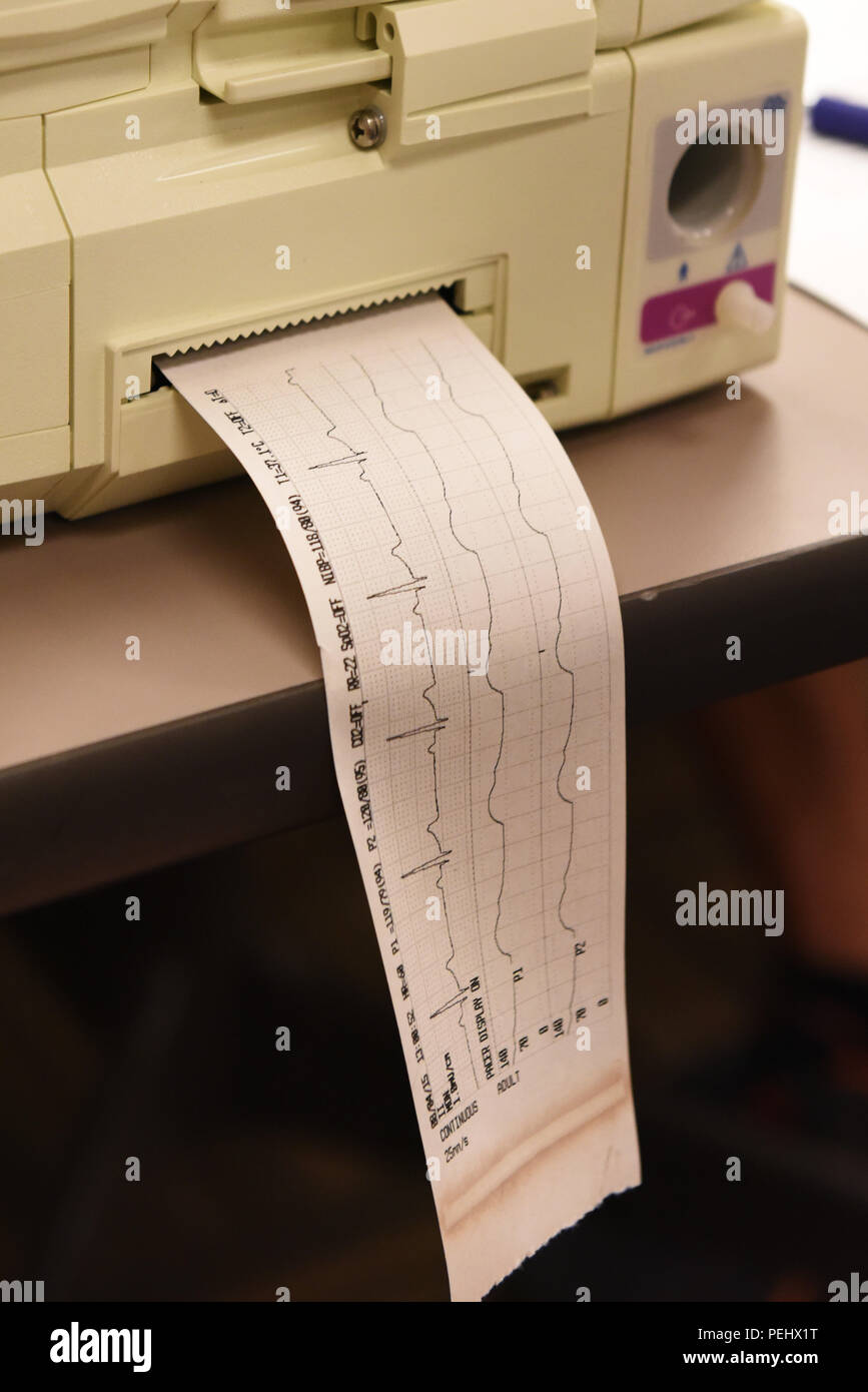 A Propaq is used to monitor a patient’s blood pressure, heart rate and ...