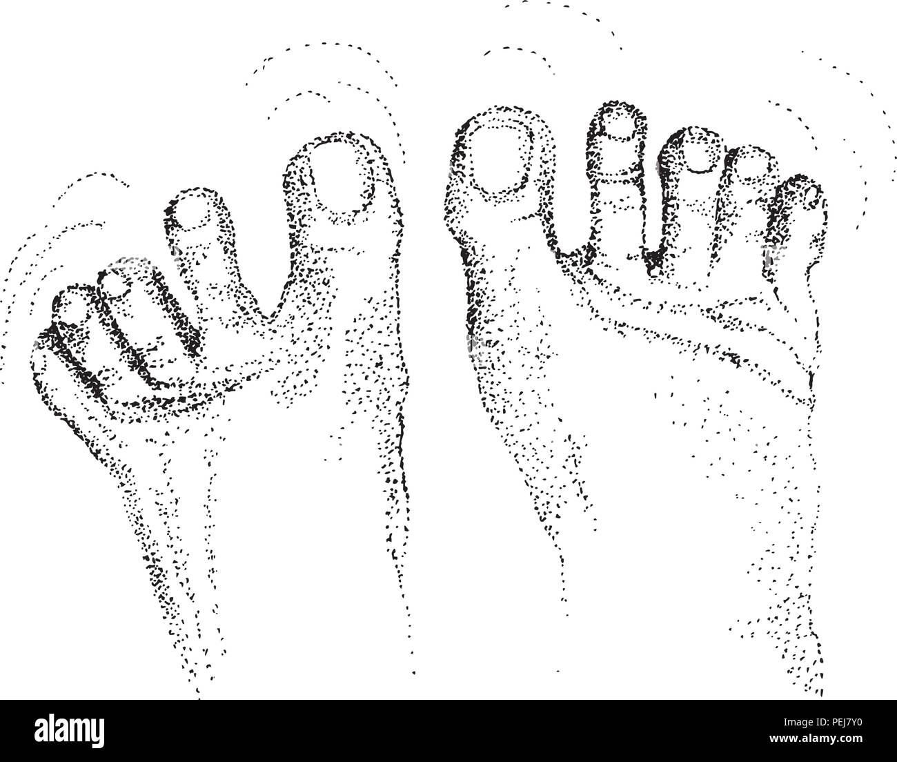 Wiggle your toes day is in August, this is the perfect graphic to ...