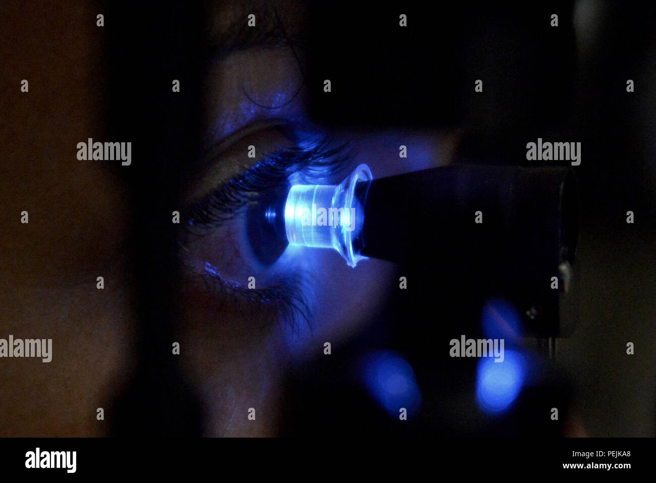 Slit lamp exam hi-res stock photography and images - Alamy
