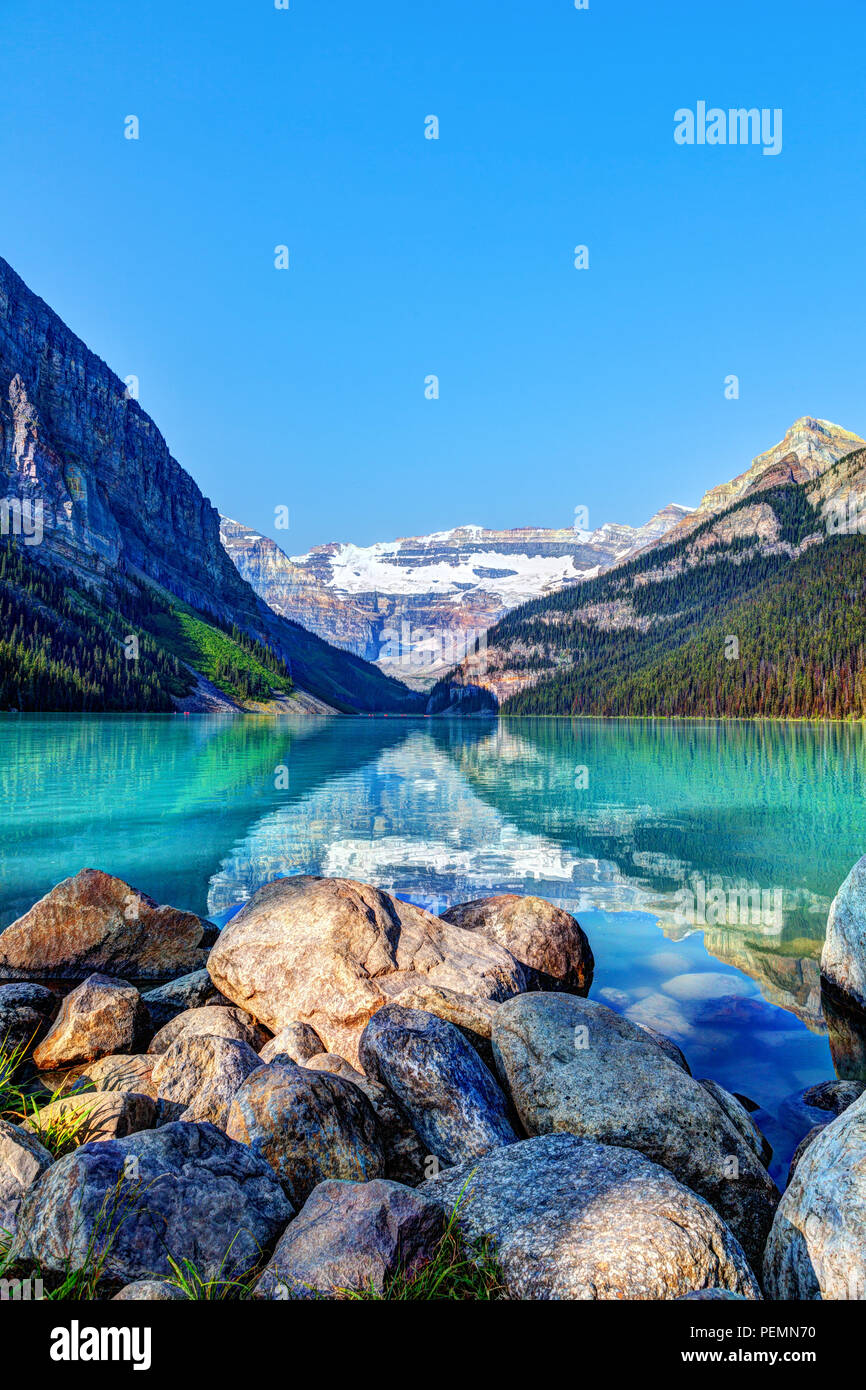 Lake Louise in Banff National Park with its glacier-fed turquoise lakes ...