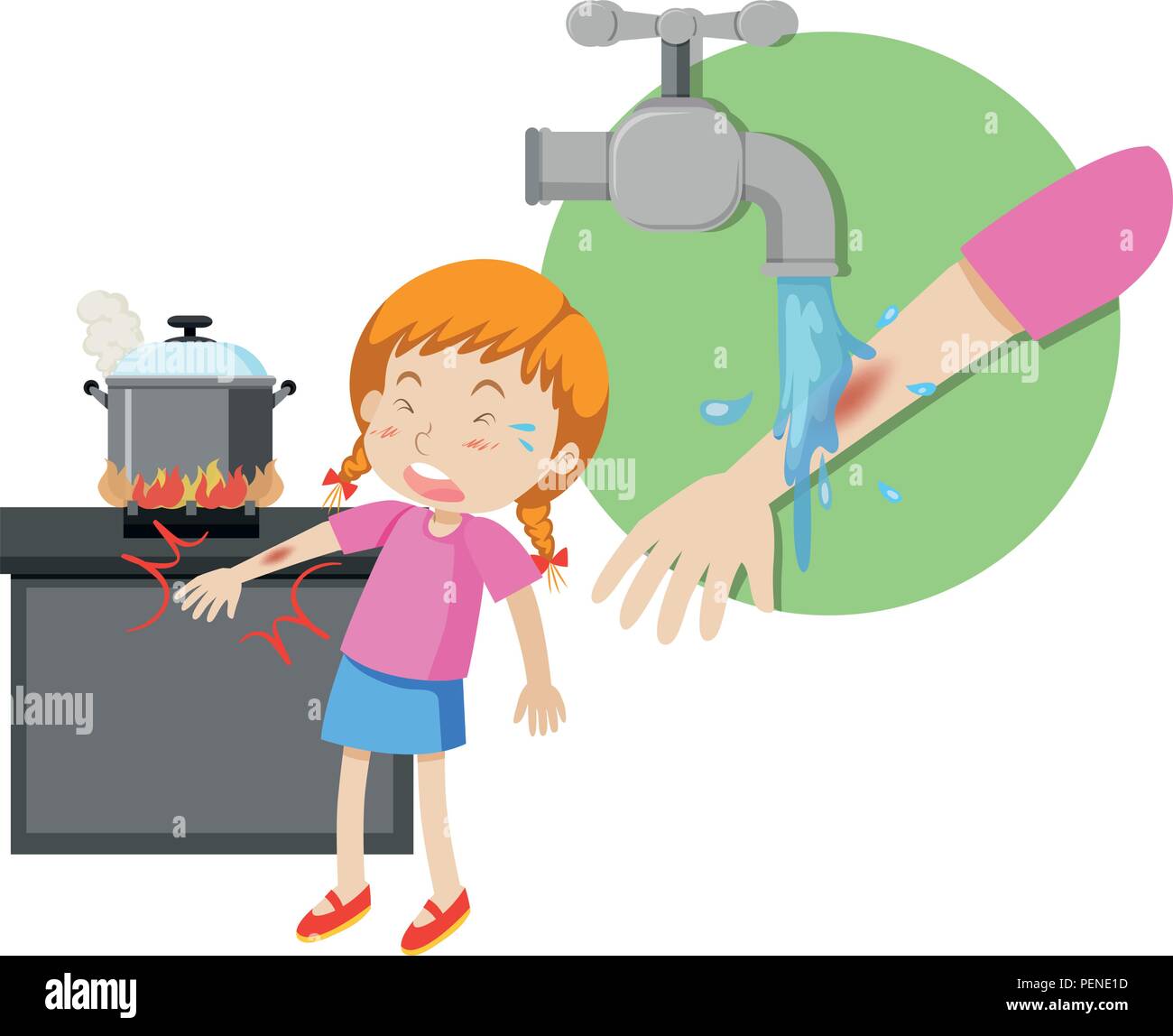 A girl first aid burn illustration Stock Vector Image & Art - Alamy