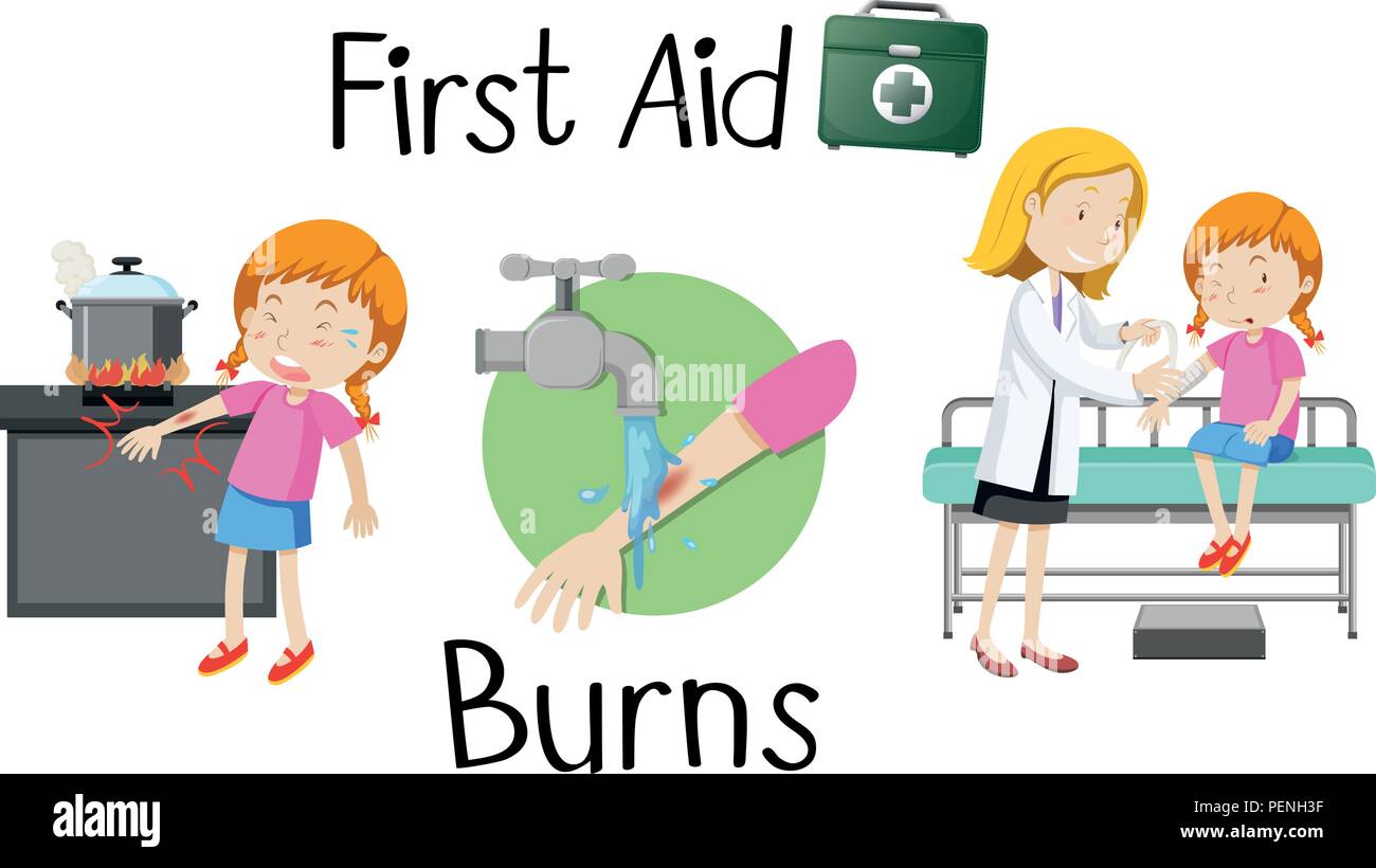 A girl with burn arm first aid illustration Stock Vector Image & Art ...