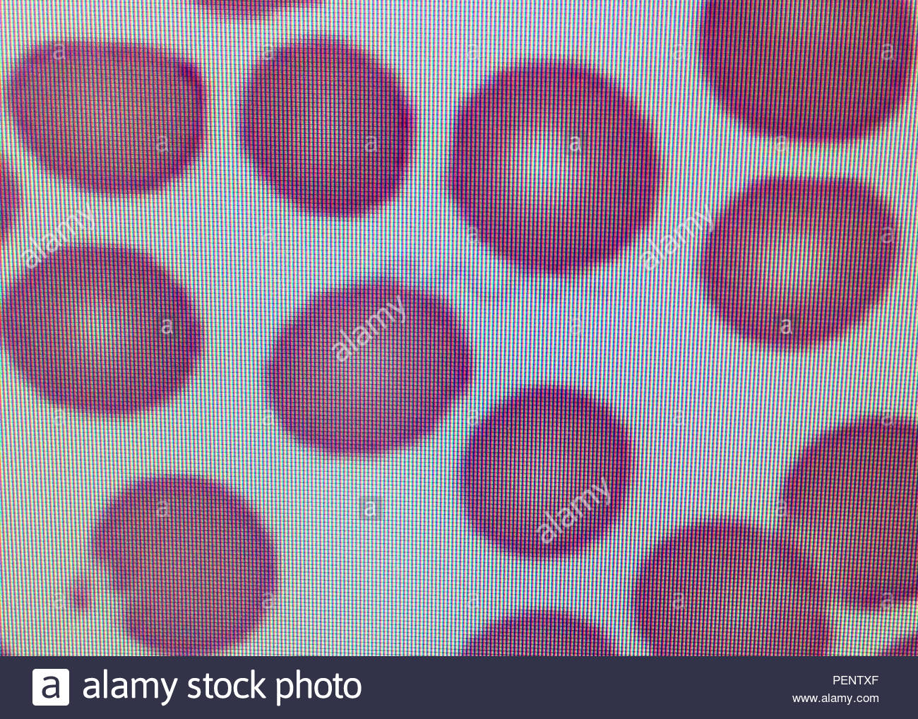 Spirochete Stock Photos & Spirochete Stock Images - Alamy