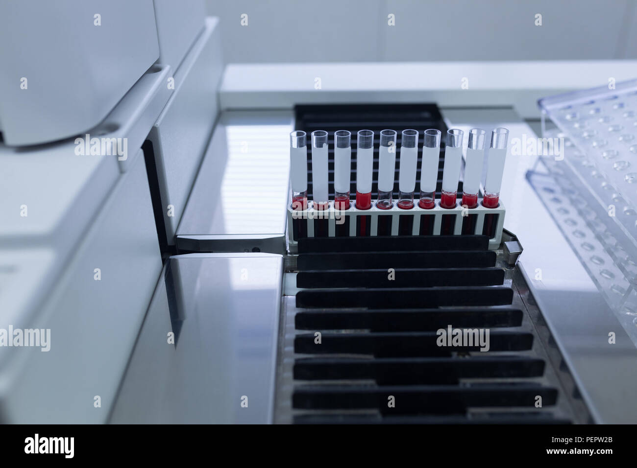Test tube in rack at blood bank Stock Photo - Alamy