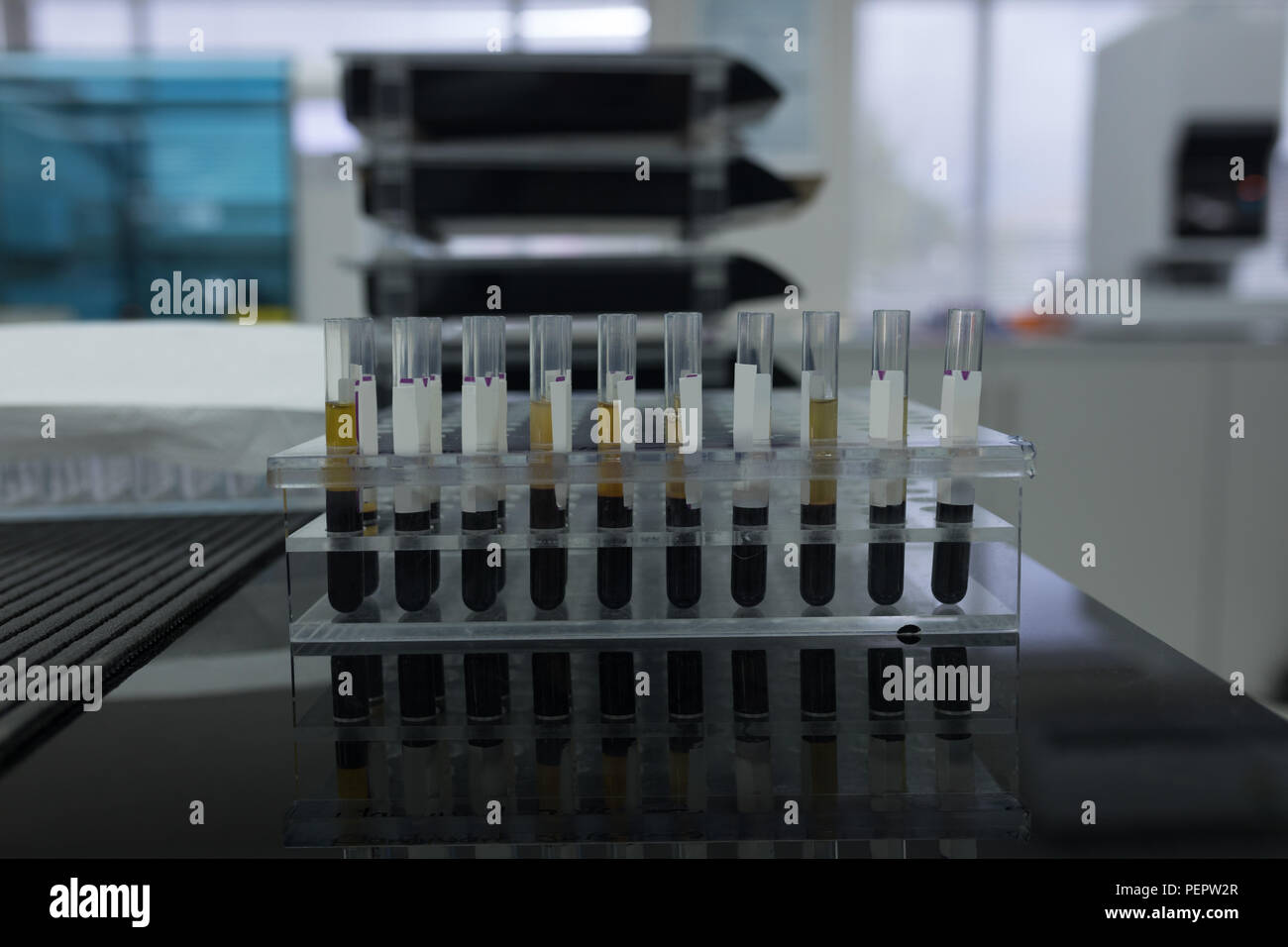 Test tube in rack at blood bank Stock Photo - Alamy