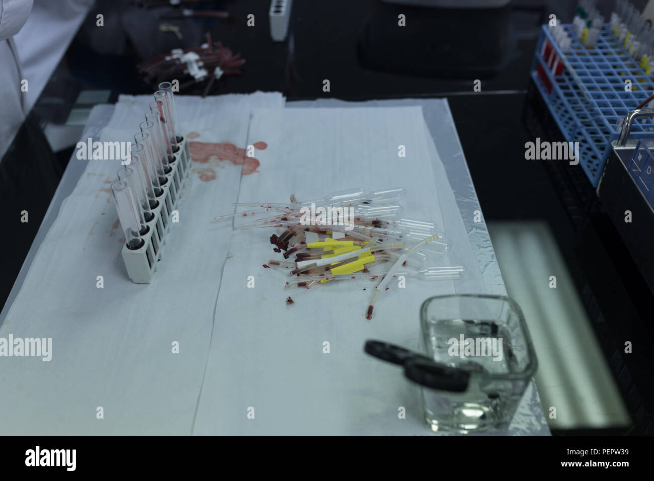 Blood Bank Test Tube at Laura Mullen blog