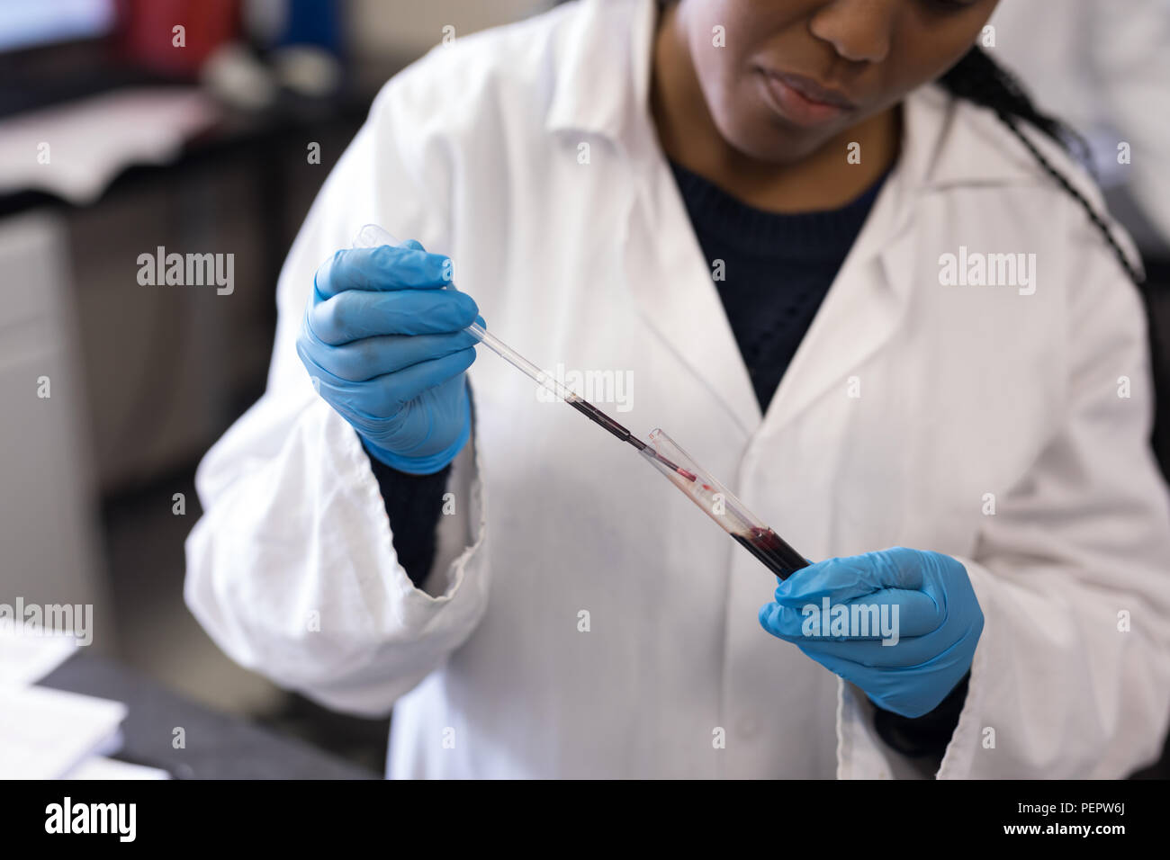 Blood analyze hi-res stock photography and images - Alamy