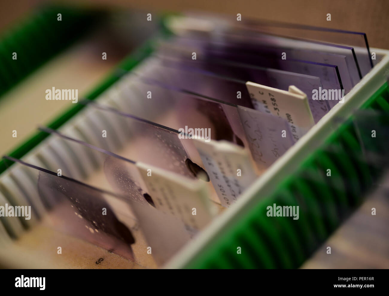 Smear slides hi-res stock photography and images - Alamy