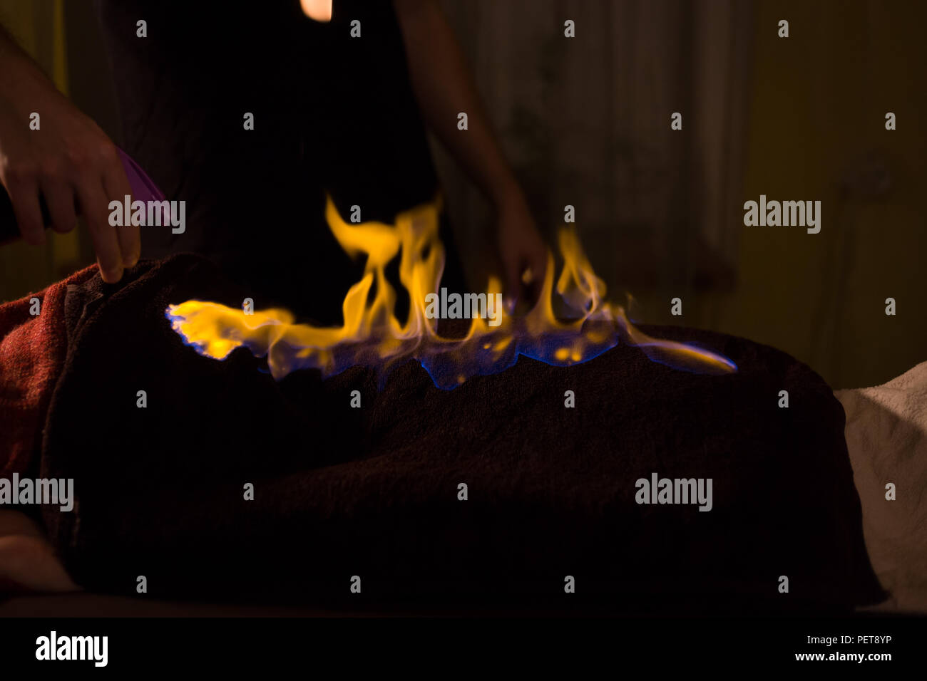 Chinese fire massage - Huo Liao therapy. Traditional chinese medicine ...