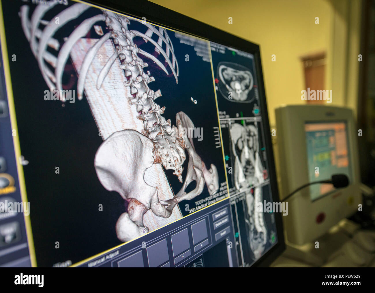 U.S. Air Force Airman 1st Class Samantha Bradford, a diagnostic imaging ...