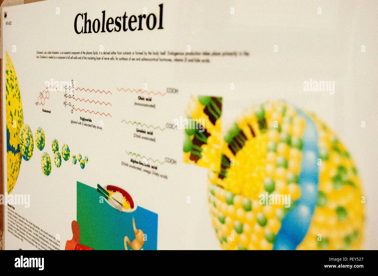 High cholesterol poster hi-res stock photography and images - Alamy