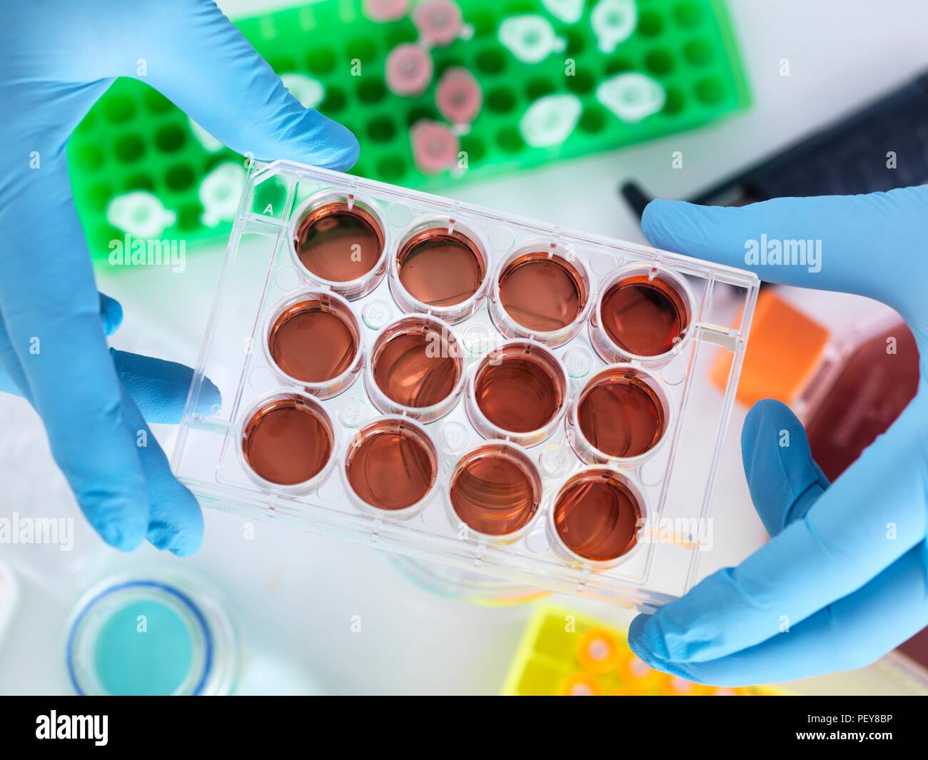 Multi cancer hi-res stock photography and images - Alamy