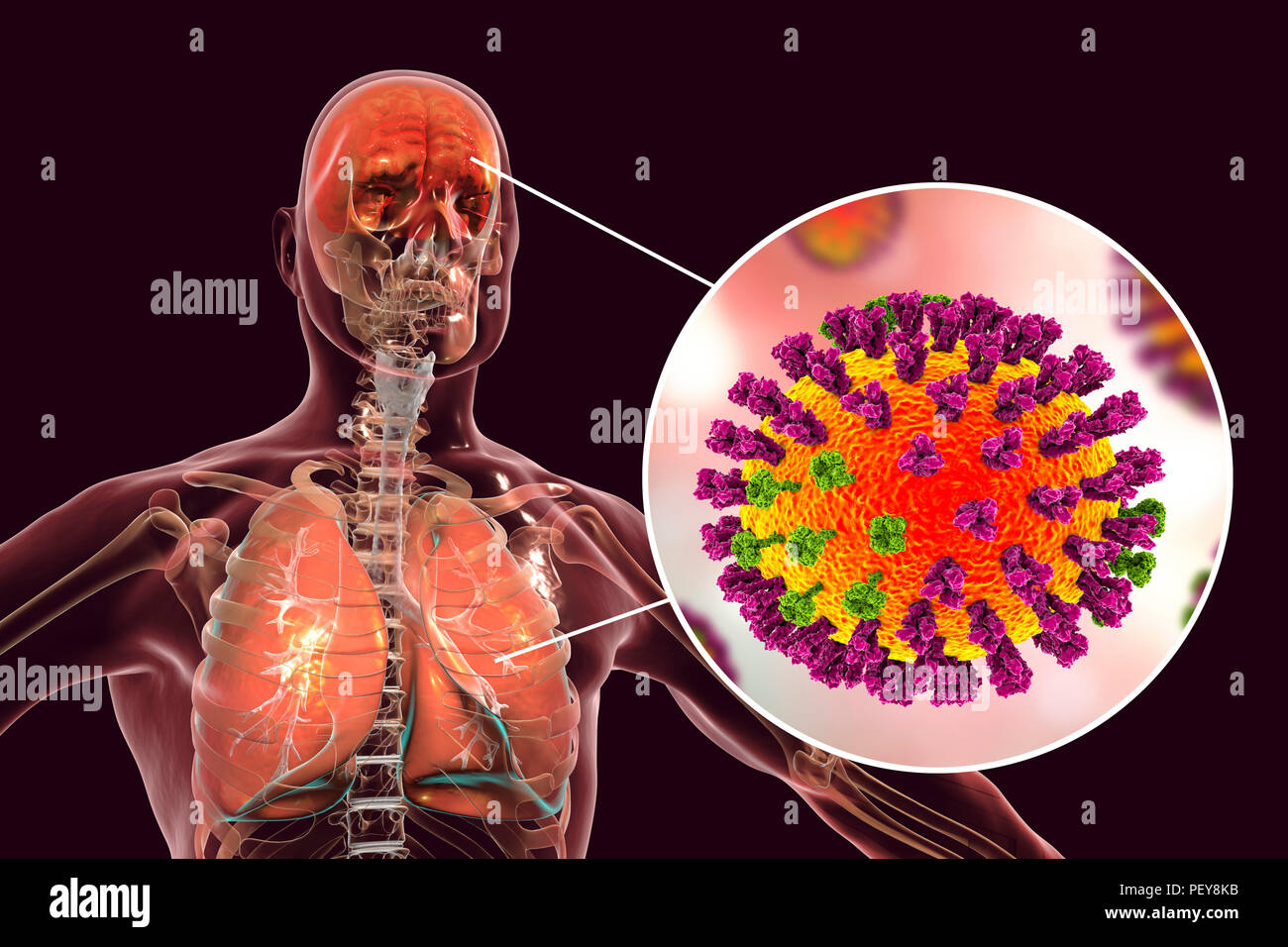Nervous system complications hi-res stock photography and images - Alamy