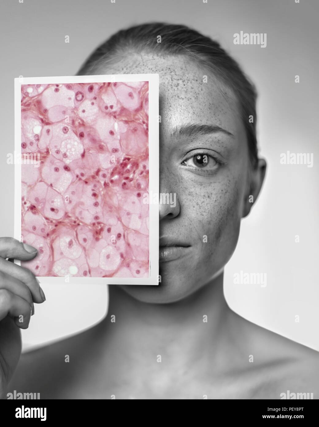 Skin histology hi-res stock photography and images - Alamy