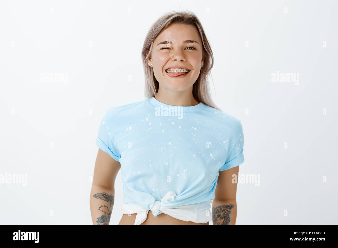 Waist Up Shot Of Carefree Emotive Young Woman With Braces And Tattoos