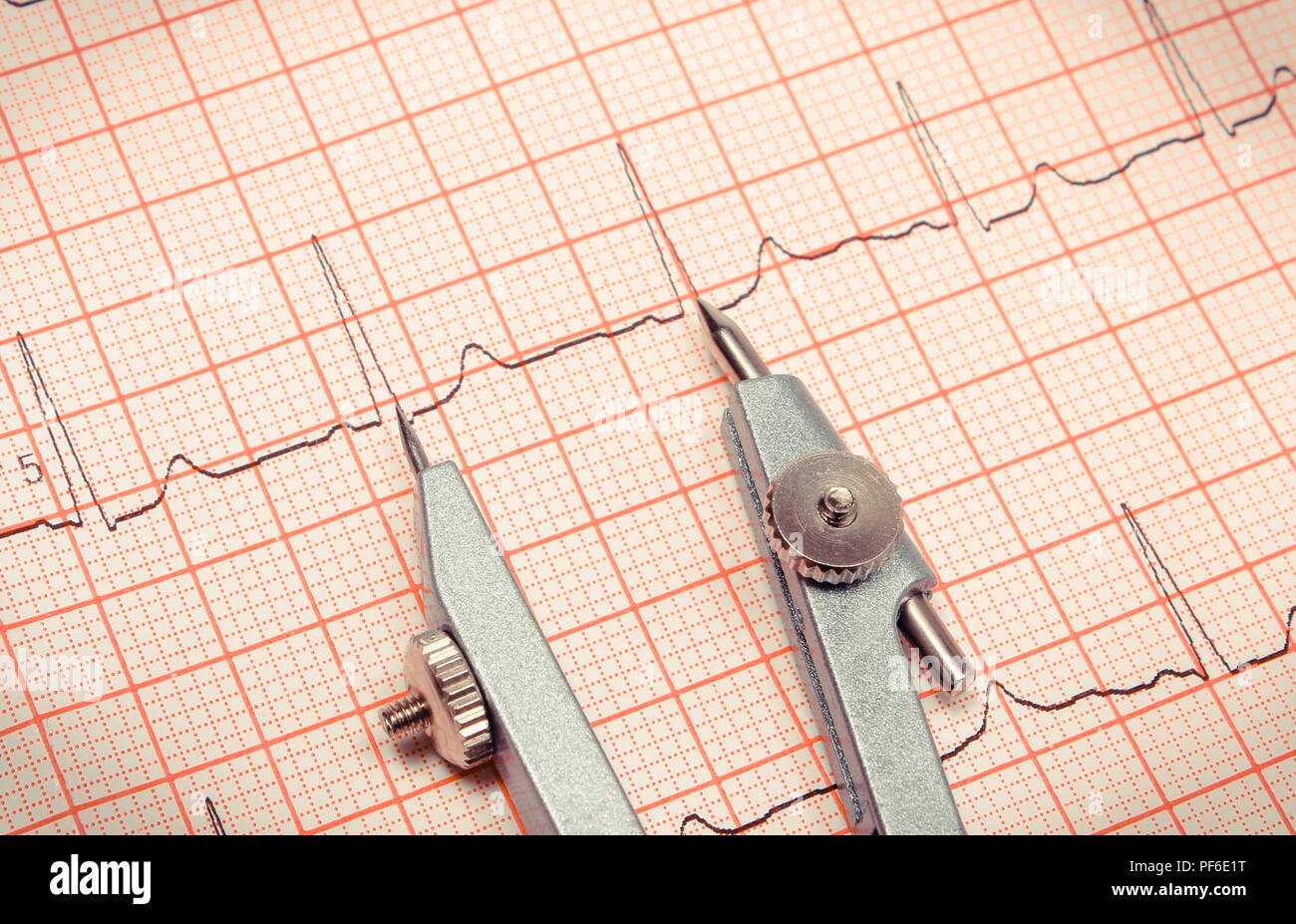 Electrocardiogram graph ekg heart rhythm with calipers, health care and ...