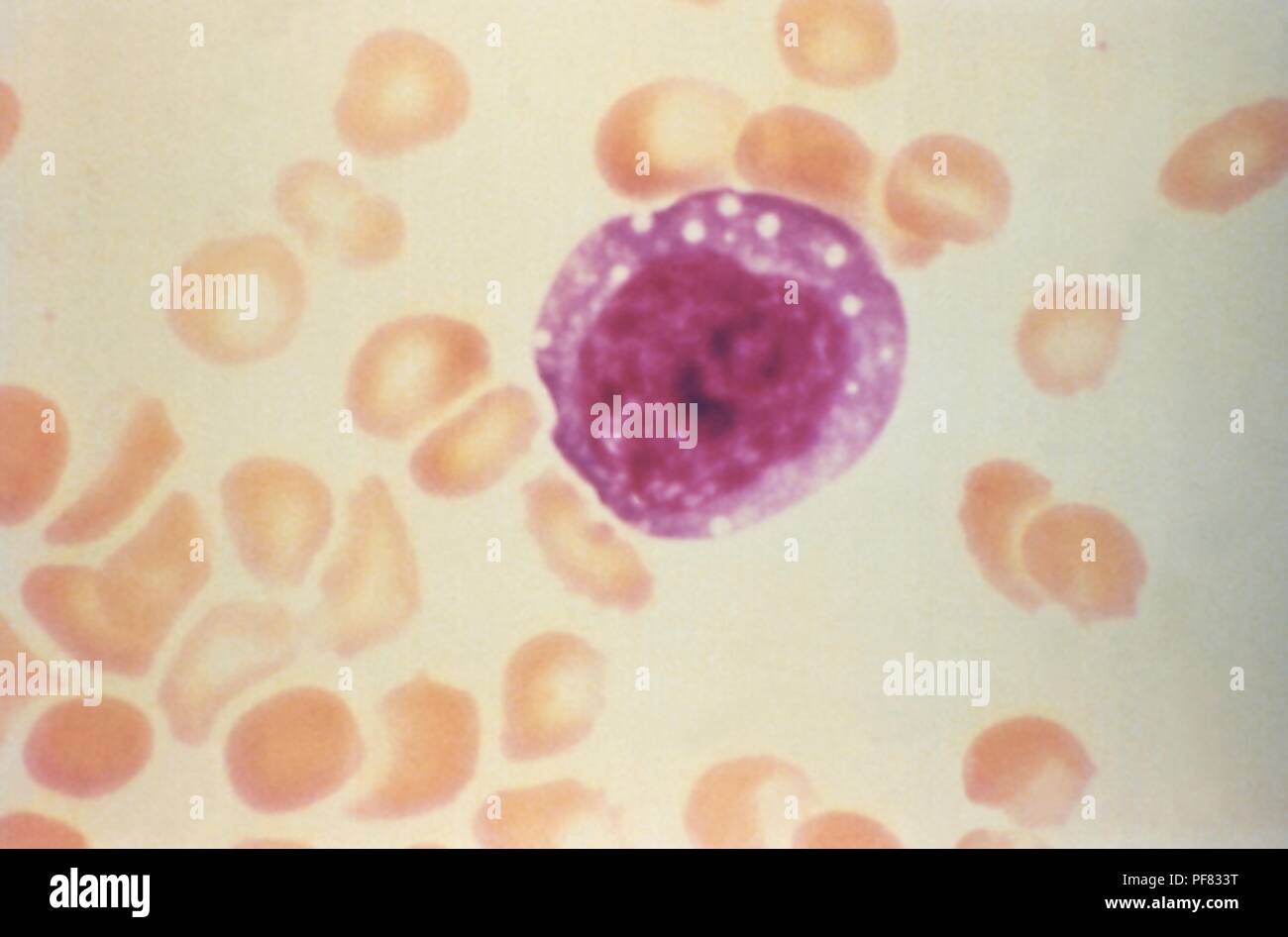 Human blood smear hi-res stock photography and images - Alamy