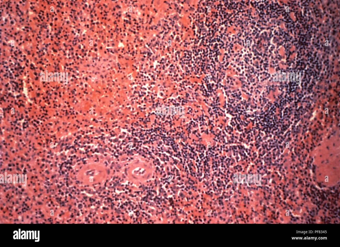 Hantavirus image courtesy hi-res stock photography and images - Alamy