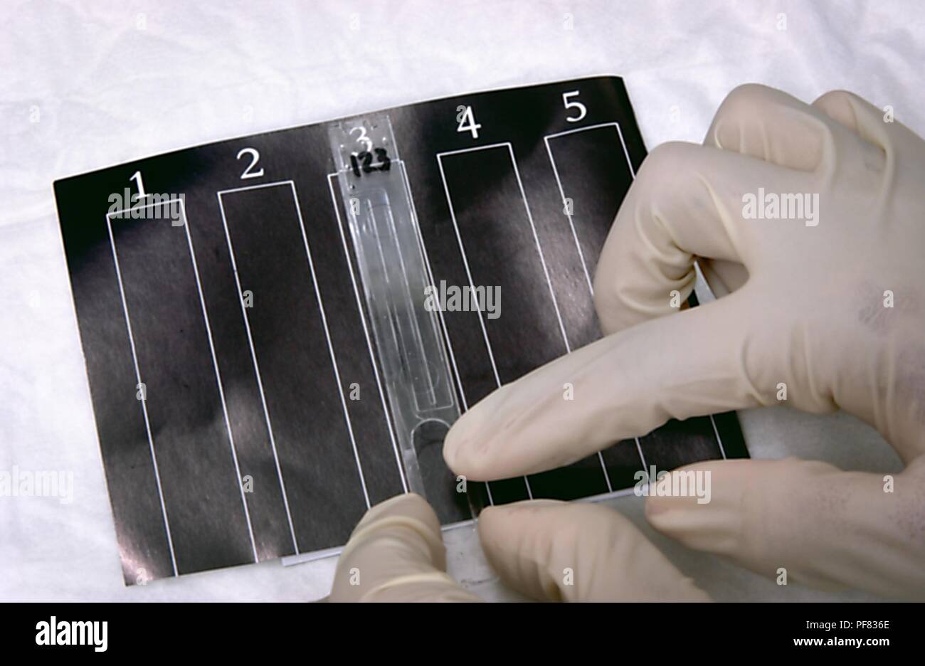 Test capillary slide hi-res stock photography and images - Alamy