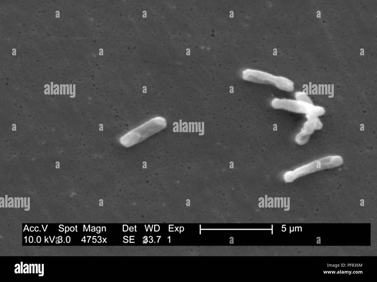 Stool Sample Stock Photos & Stool Sample Stock Images - Alamy