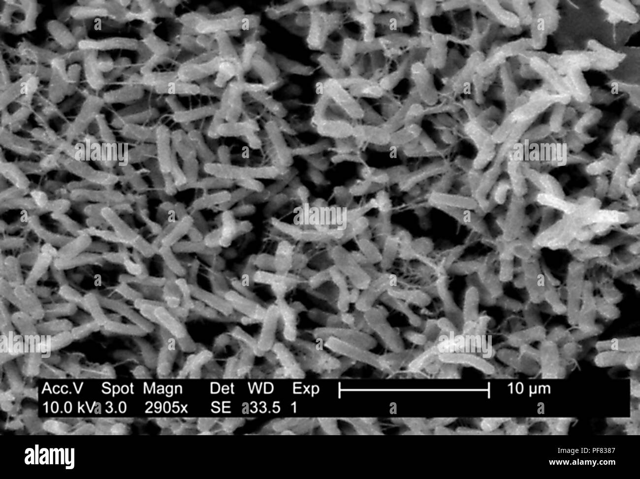 Gram-positive Clostridium difficile bacteria revealed in the stool ...