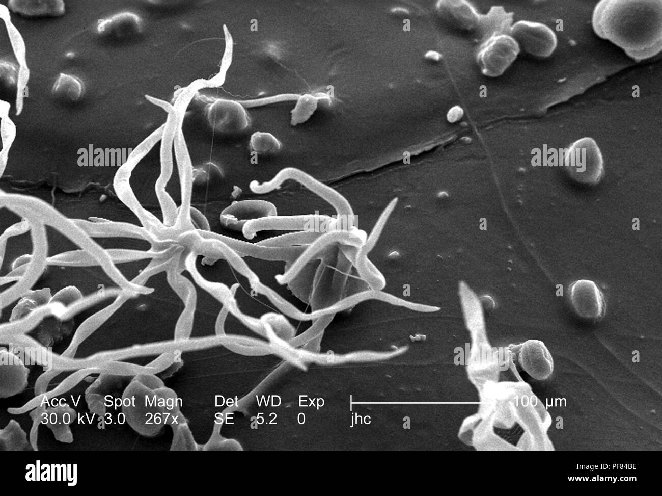 V cal hi-res stock photography and images - Alamy