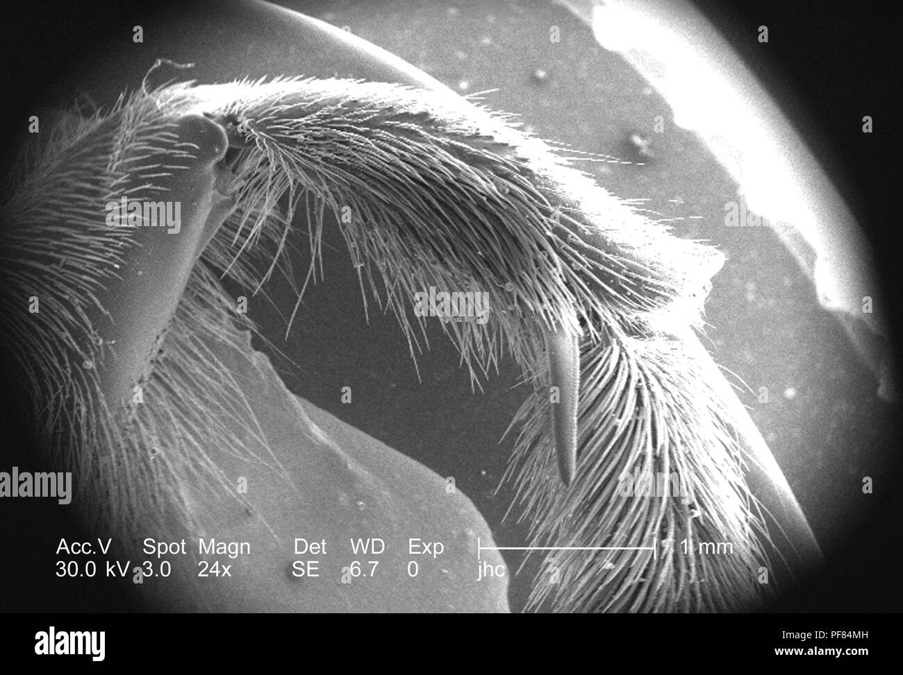 Tibial spur hi-res stock photography and images - Alamy