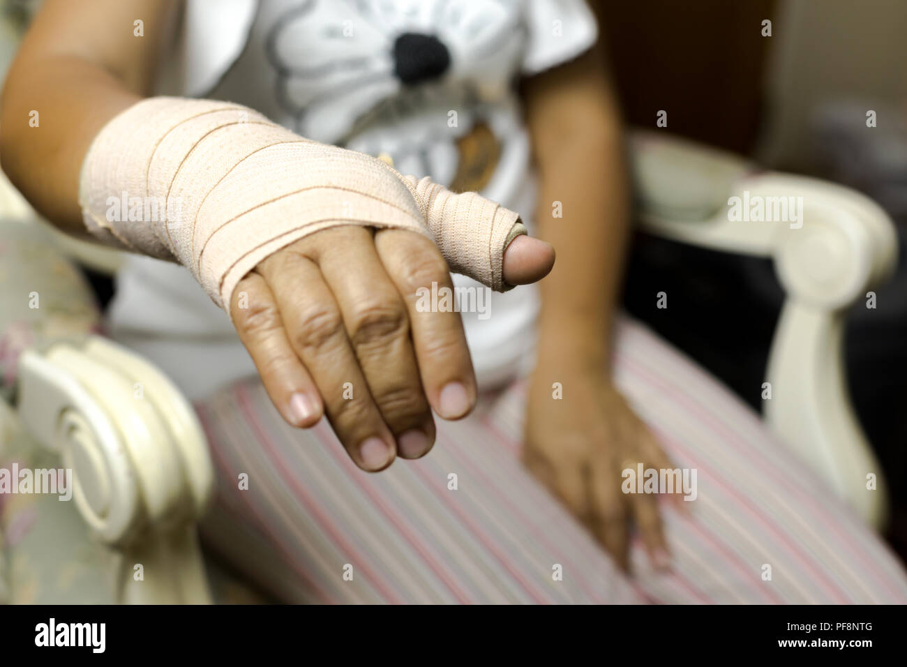 Woman sitting on a chair with Splint broken bone on her hand Stock ...
