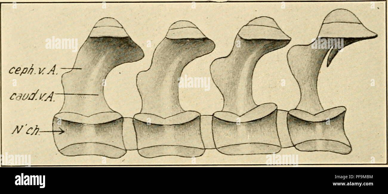 Four constricted bodies hi-res stock photography and images - Alamy