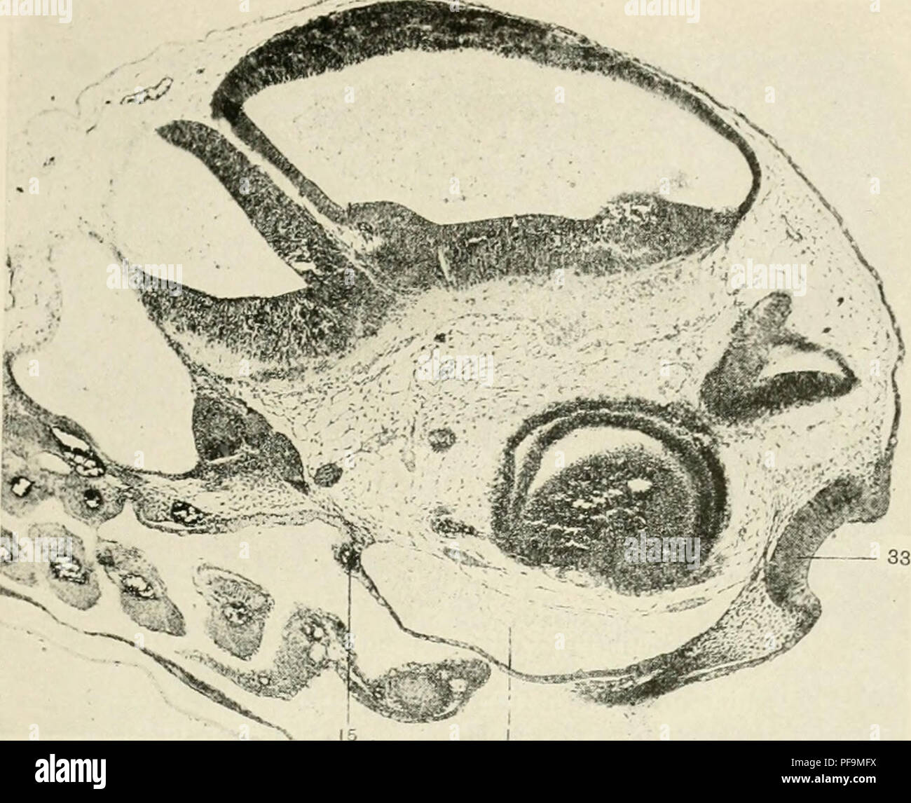 This study explores the development of the lymphatic system in fish ...
