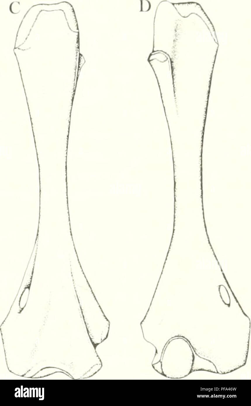 Proximal humerus hi-res stock photography and images - Alamy