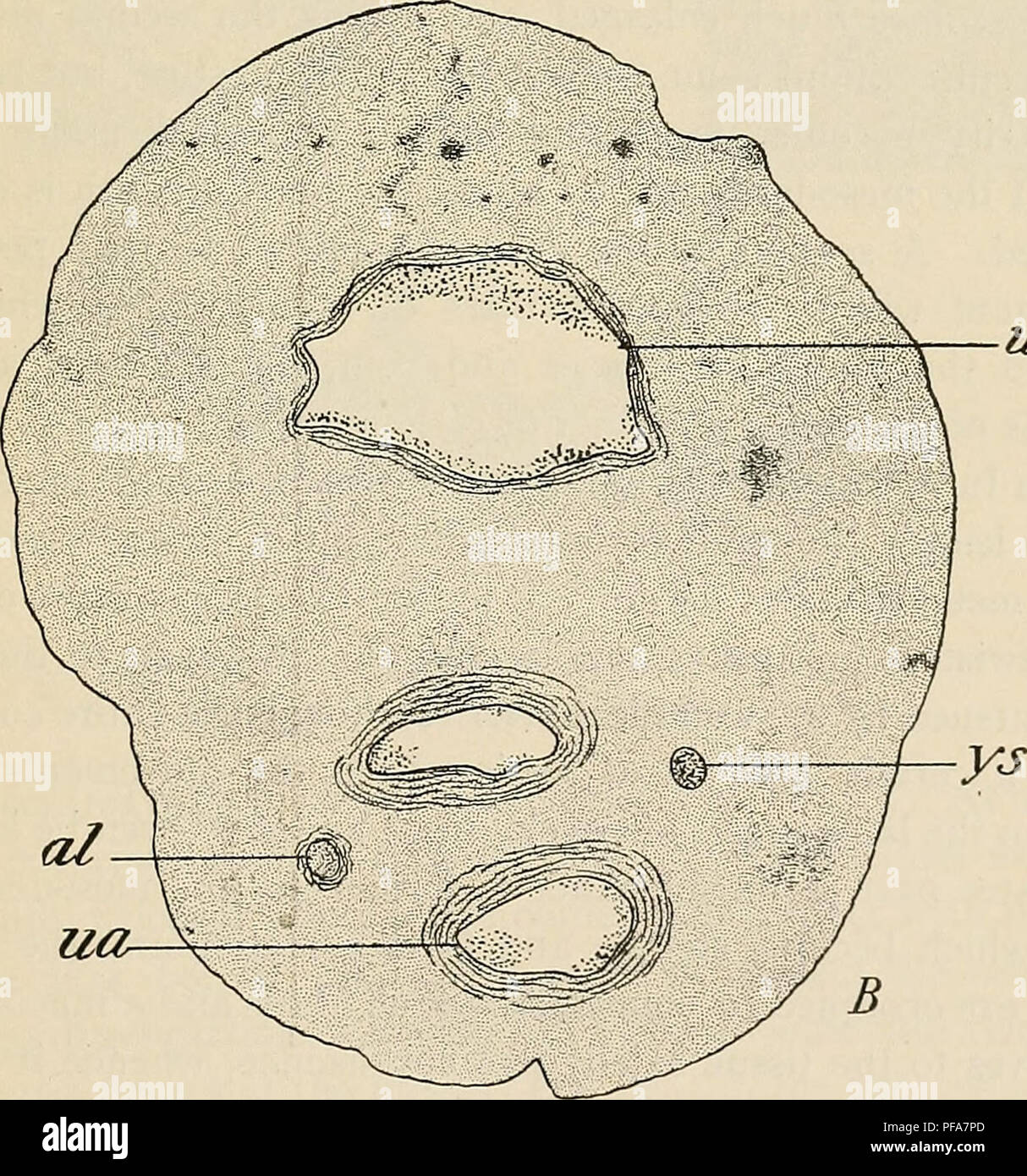 Umbilical vein hi-res stock photography and images - Alamy