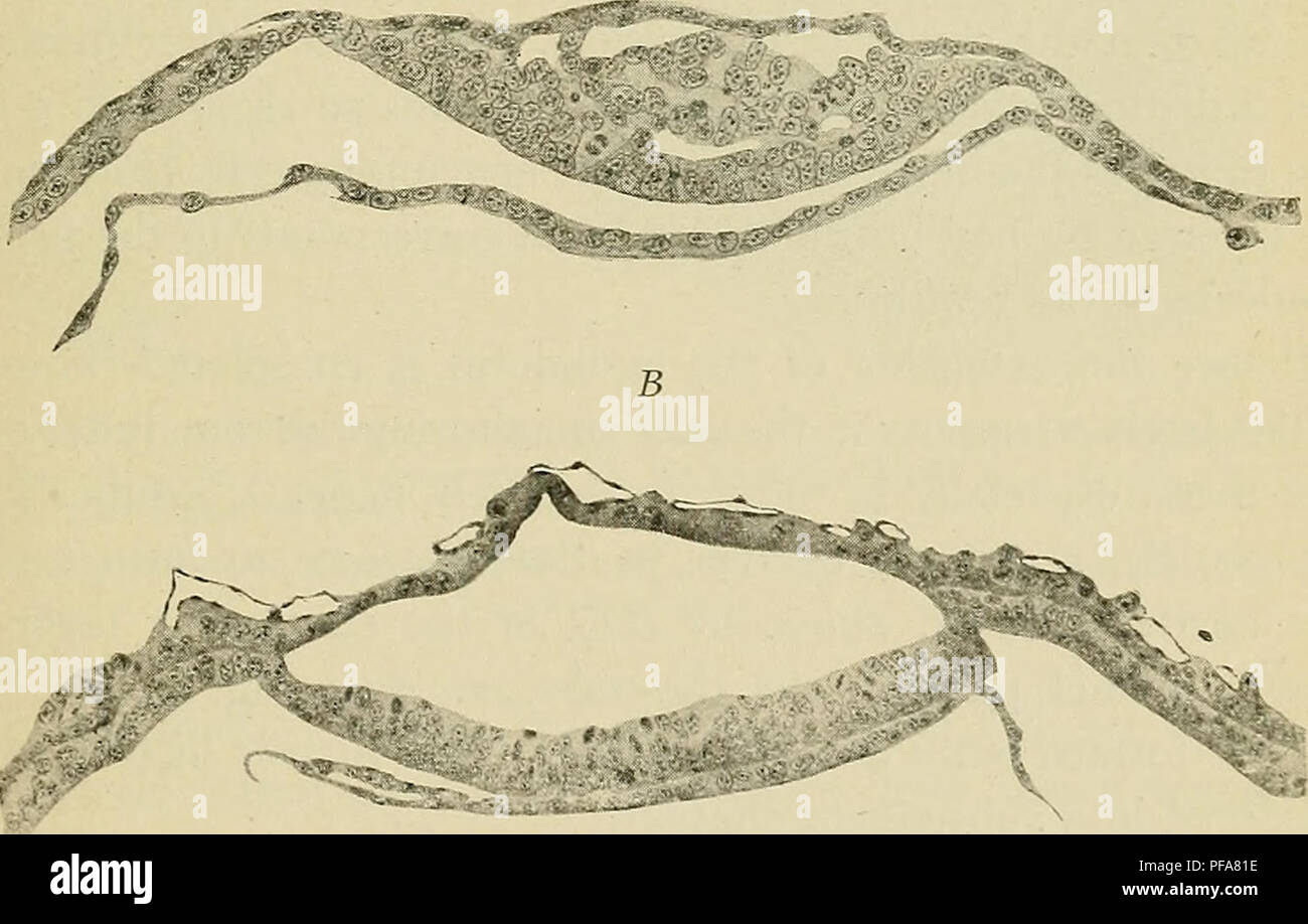 Amniotic cavity hi-res stock photography and images - Alamy