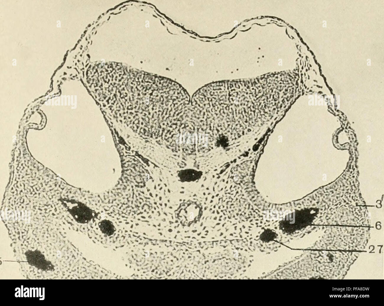 This study focuses on the development of the lymphatic system in fish ...