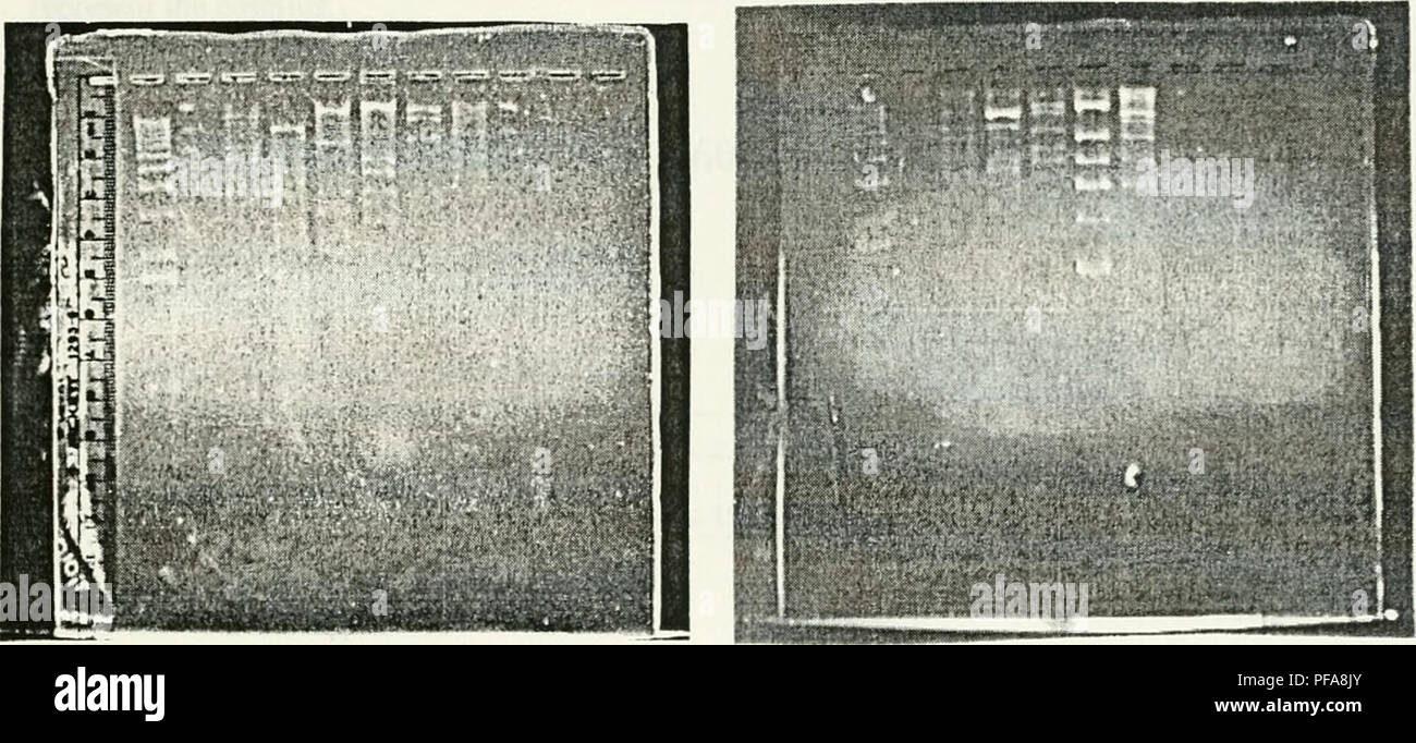 This study details the development of a cosmid map of chromosome 12p13 ...