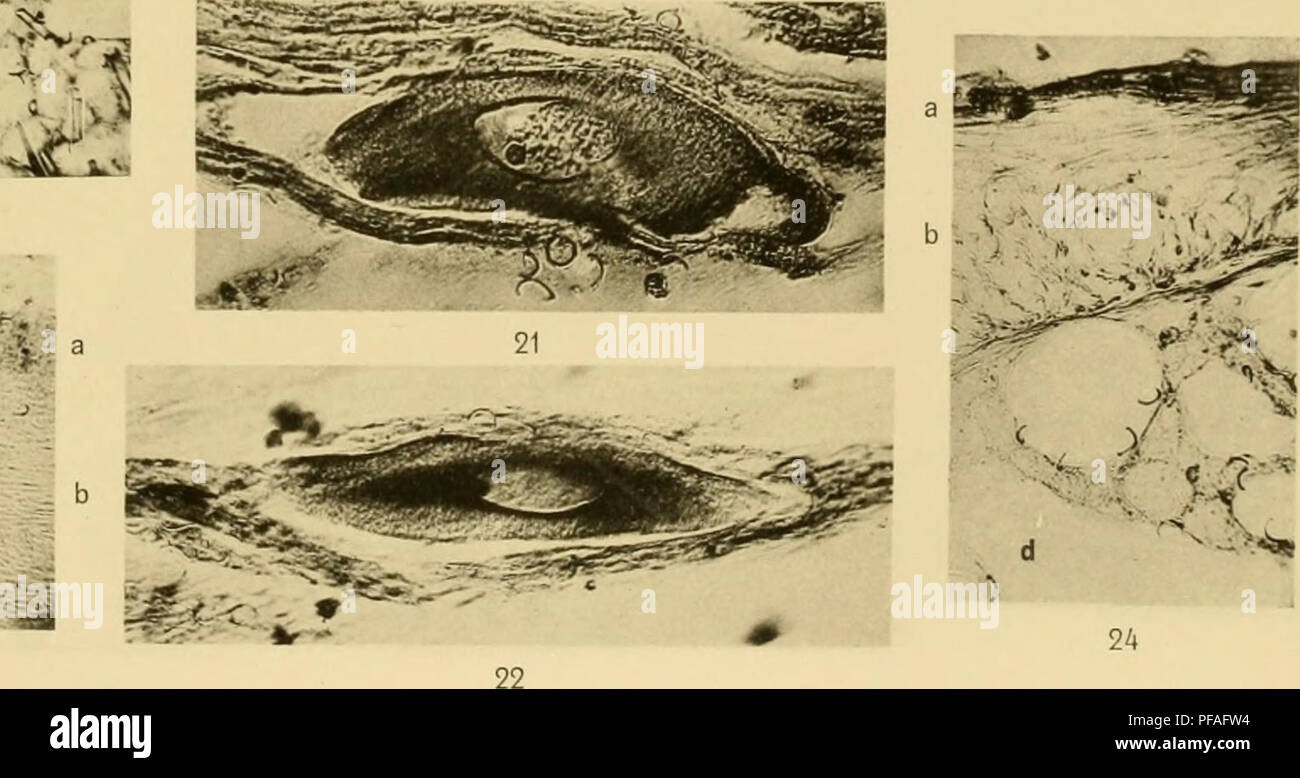 Sagitta sp hi-res stock photography and images - Alamy