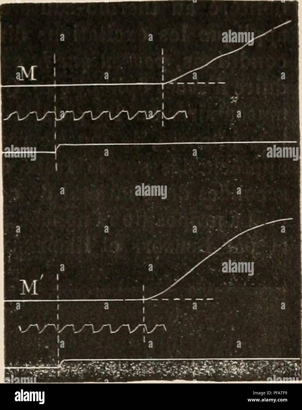 Nerve conduction hi-res stock photography and images - Alamy