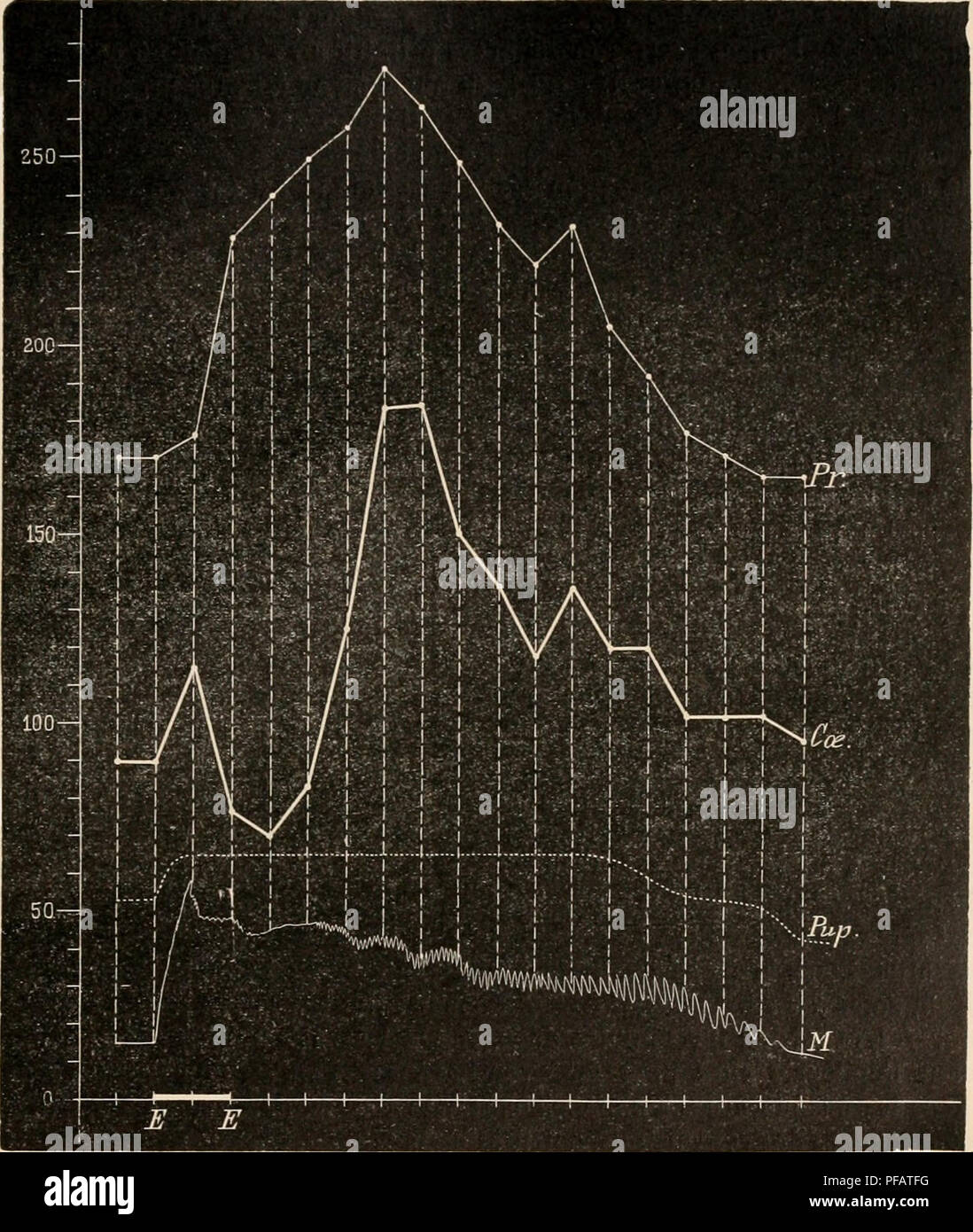 This physiology dictionary entry explains cortical epilepsy, detailing ...