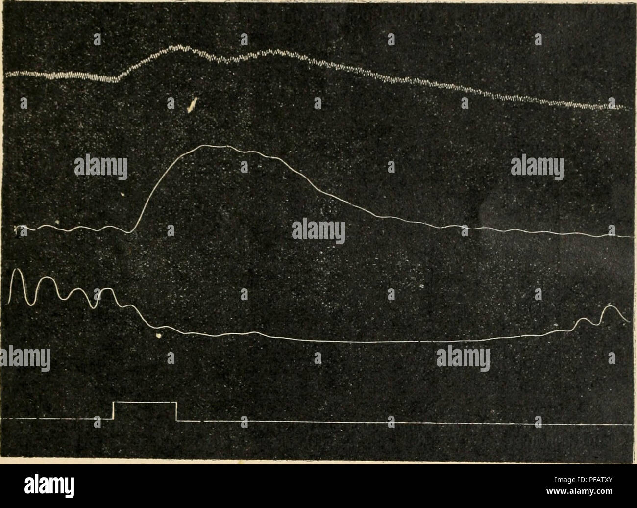 This physiology dictionary focuses on the human digestive system ...
