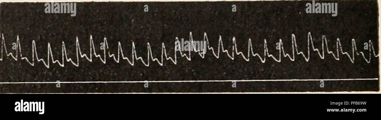 Exercices de respiration hi-res stock photography and images - Alamy
